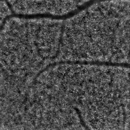 rtx1 - Adaptive optics retinal camera • Imagine Eyes