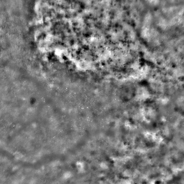 rtx1 - Adaptive optics retinal camera • Imagine Eyes