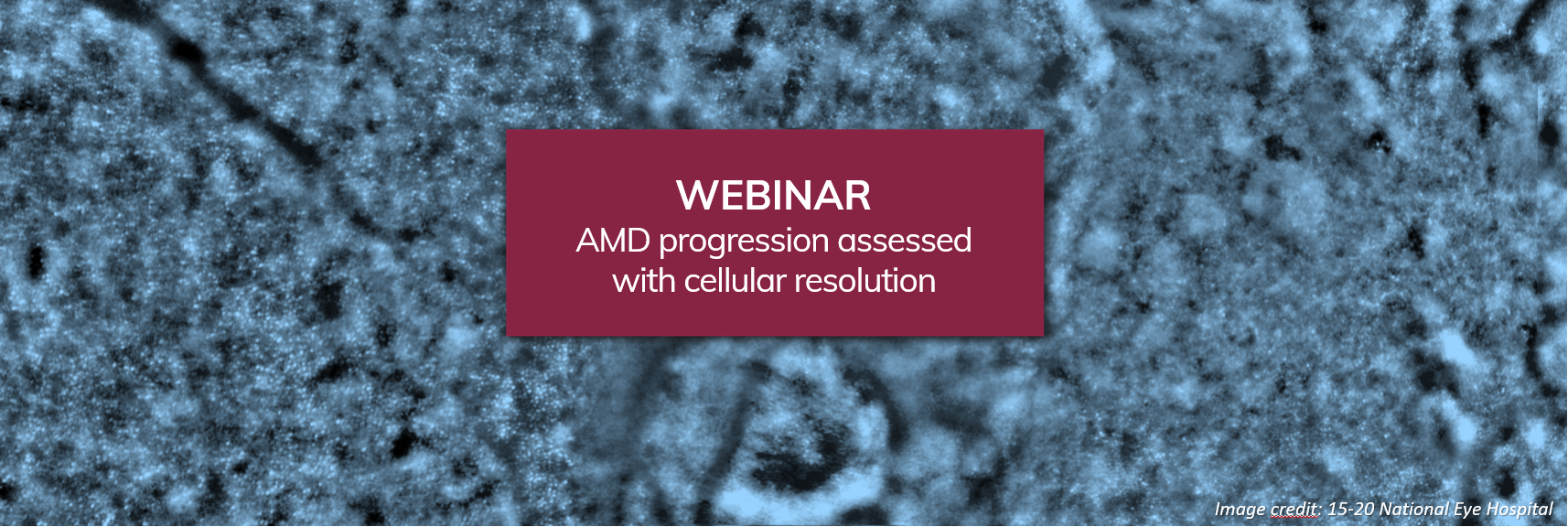 Replay available - Tracking AMD progression at the cellular scale ...