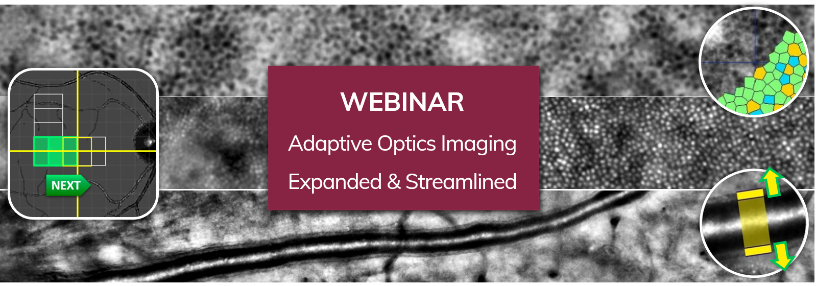 WEBINAR -- Adaptive Optics Imaging: Expanded and Streamlined • Imagine Eyes