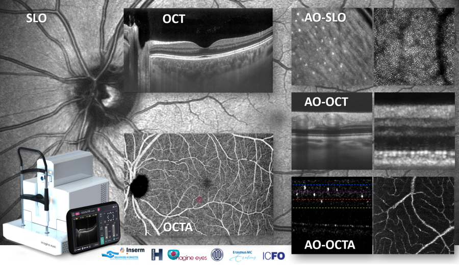 Retinal adaptive optics imaging goes multimodal • Imagine Eyes Retinal adaptive optics imaging goes multimodal • Imagine Eyes