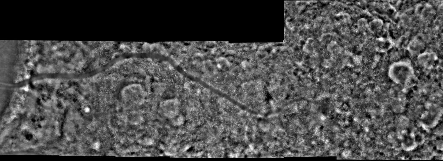 Adaptive optics retinal imaging | rtx1 camera | Imagine Eyes