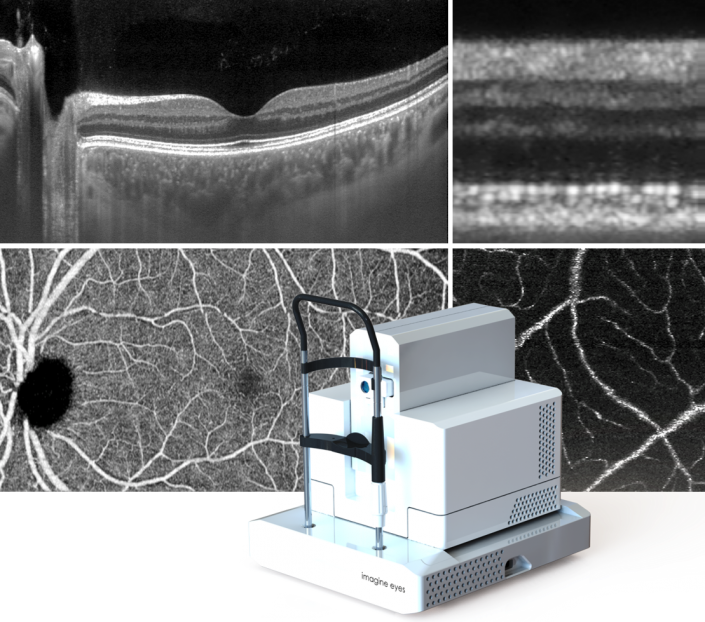 Lecture demonstrates a cellular-level retinal OCT and artifact-free ...