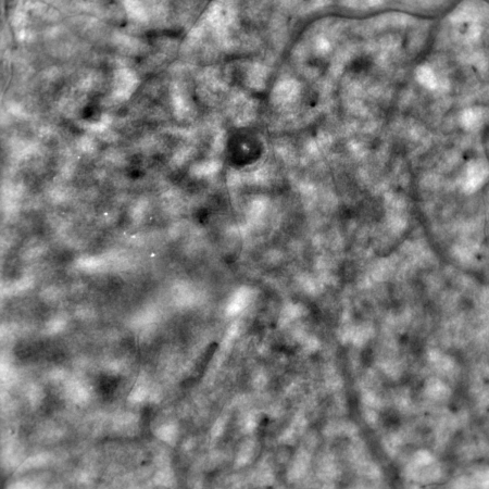 rtx1 - Adaptive optics retinal camera • Imagine Eyes