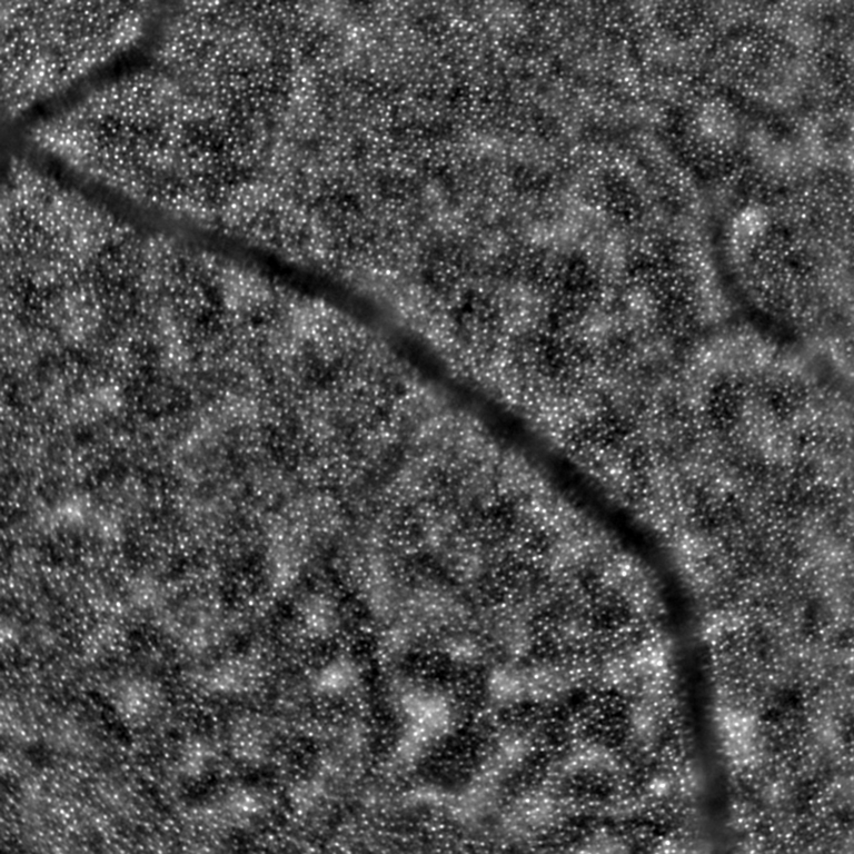 rtx1 - Adaptive optics retinal camera • Imagine Eyes