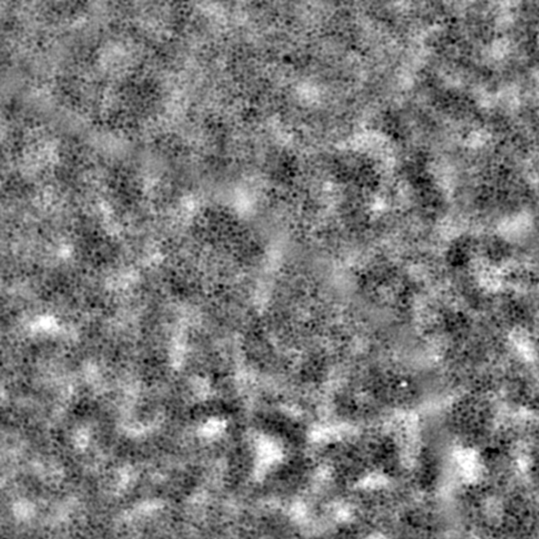 rtx1 - Adaptive optics retinal camera • Imagine Eyes