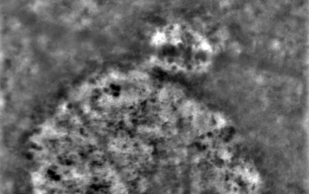 Adaptive optics retinal imaging | rtx1 camera | Imagine Eyes