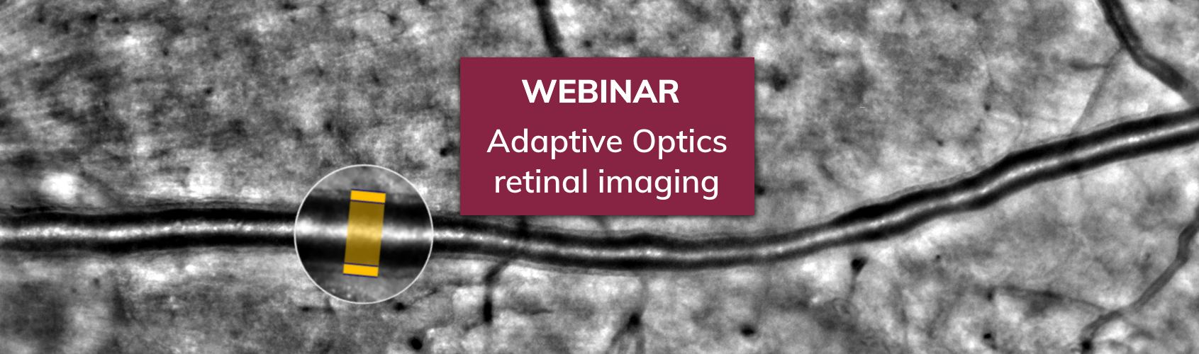 Replay available: Webinar on microvascular AO imaging • Imagine Eyes