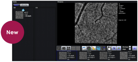 rtx1 - Adaptive optics retinal camera • Imagine Eyes