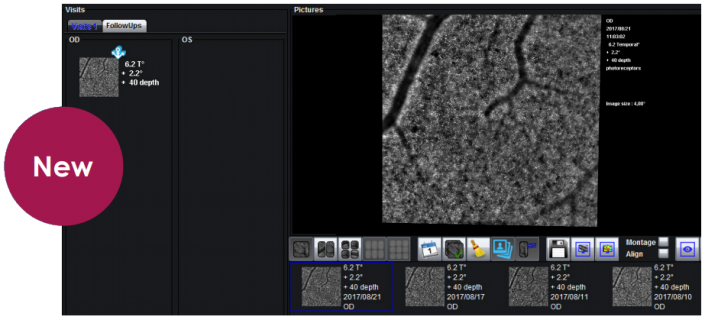 rtx1 - Adaptive optics retinal camera • Imagine Eyes