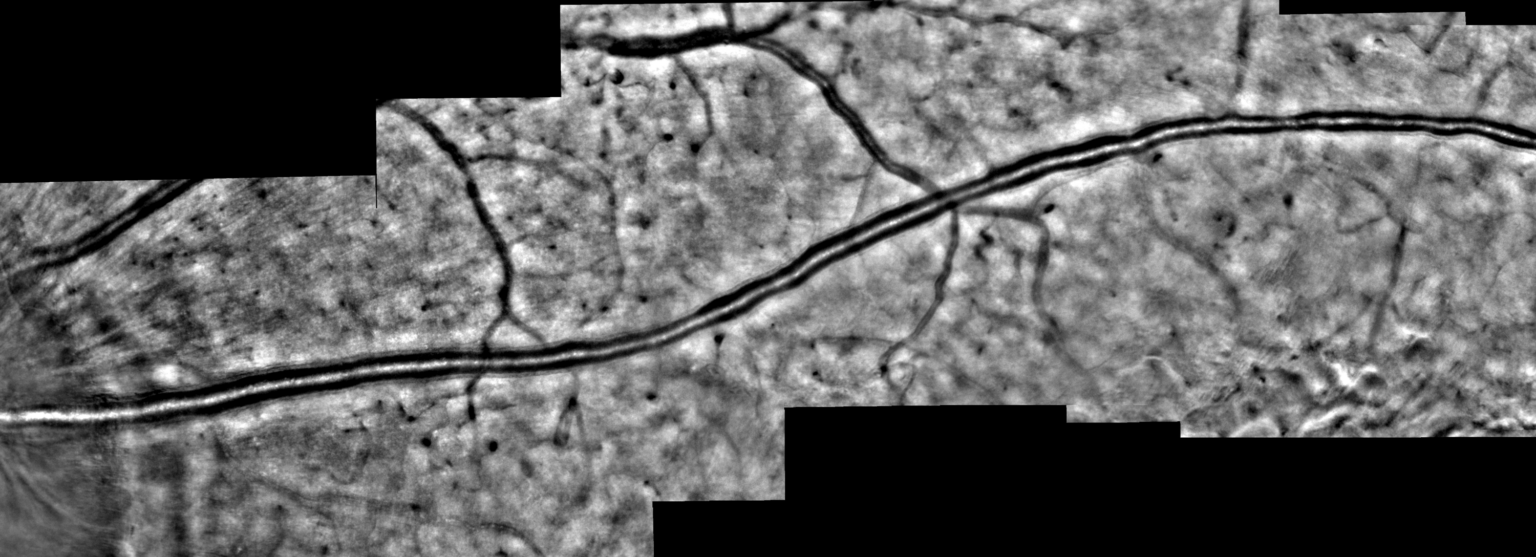 Adaptive optics retinal imaging | rtx1 camera | Imagine Eyes